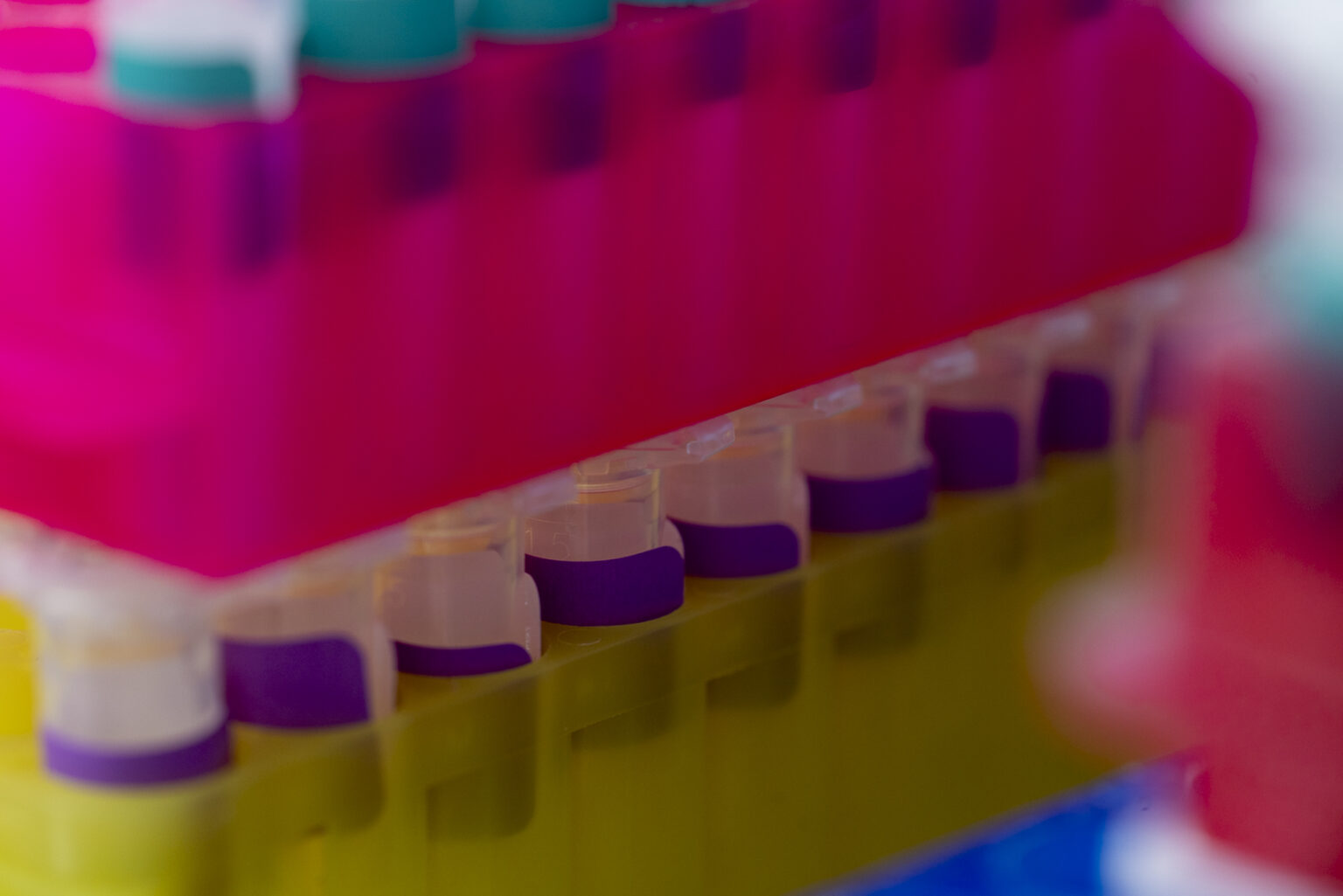 Atuka - A cure for Parkinson’s, faster, through the world’s best ...