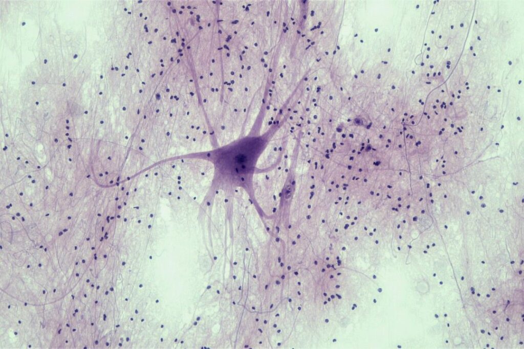 The widest range of industry-leading Parkinson’s disease models - Atuka